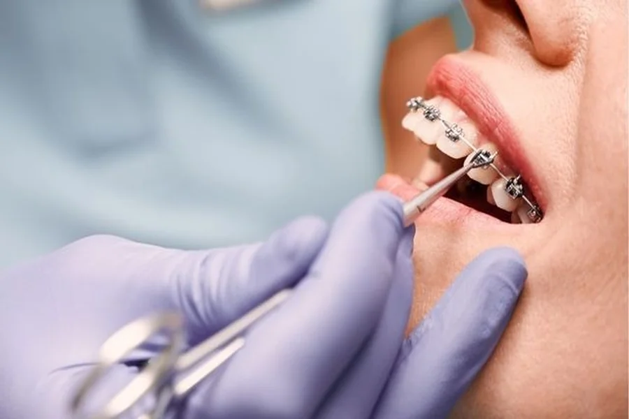 The Connection Between Orthodontics And Jaw Health